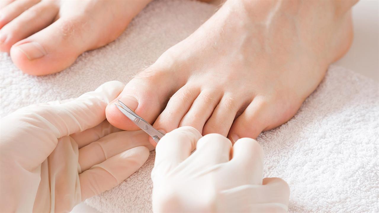 Νύχια που μπαίνουν στο δέρμα: Πώς το αποφεύγουμε