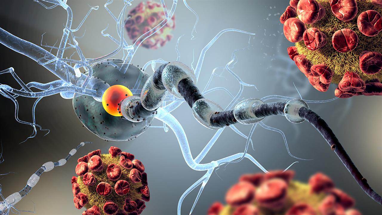 Τα αυτοάνοσα νοσήματα αυξάνουν τον κίνδυνο για καρδιοπάθεια