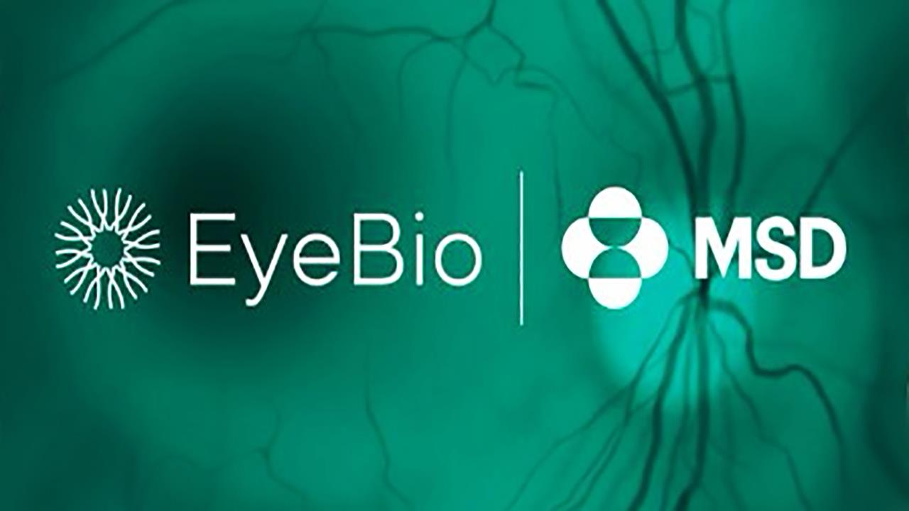 Η MSD μέσω θυγατρικής εταιρείας ανακοίνωσε την εξαγορά της EyeBio
