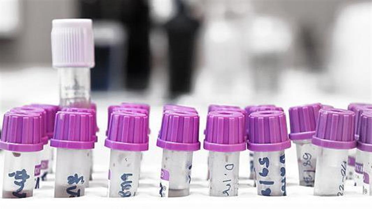 Εξετάσεις σε προσιτές τιμές από τη Βιοιατρική, με αφορμή τη Γιορτή της ...